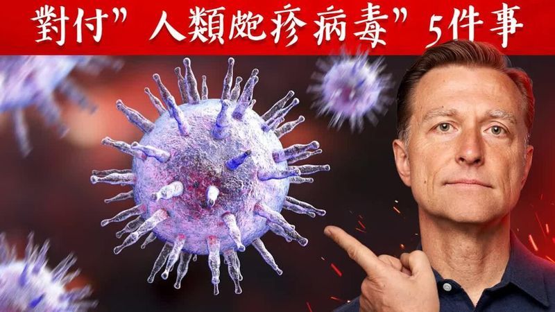 人类疱疹病毒(EB病毒),要知道5件事,自然疗法,柏格医生DrBerg