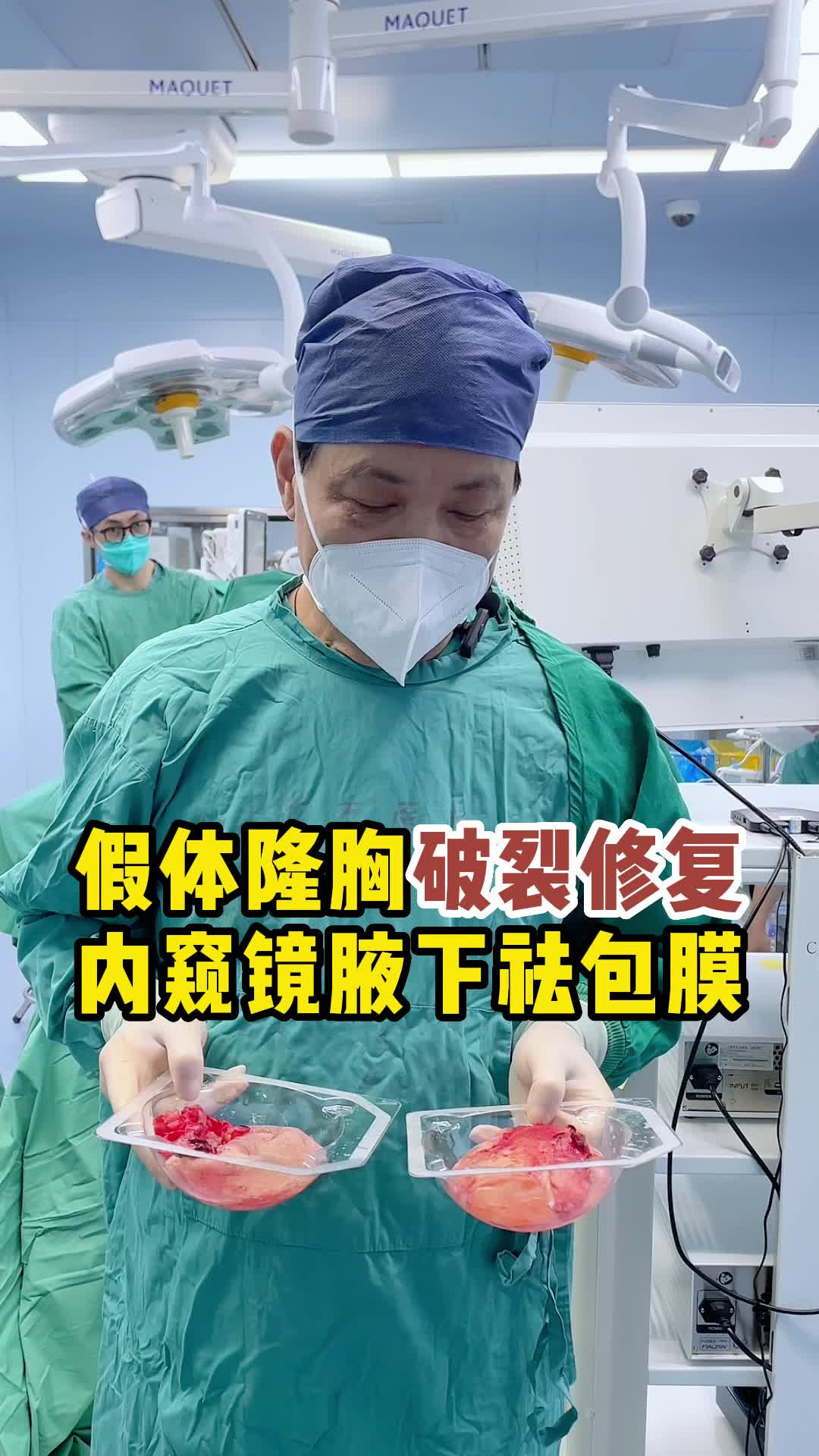 这位姑娘在外院做的假体隆胸出现破裂,通过内窥镜+超声刀从腋下取出...