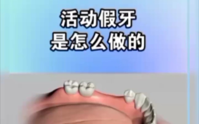 一起来了解下,活动假牙的制作过程吧～