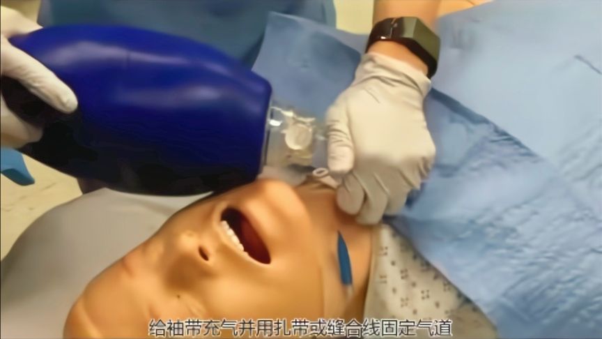 关键时刻能救命的气管切开术介绍 专业医学视频科普