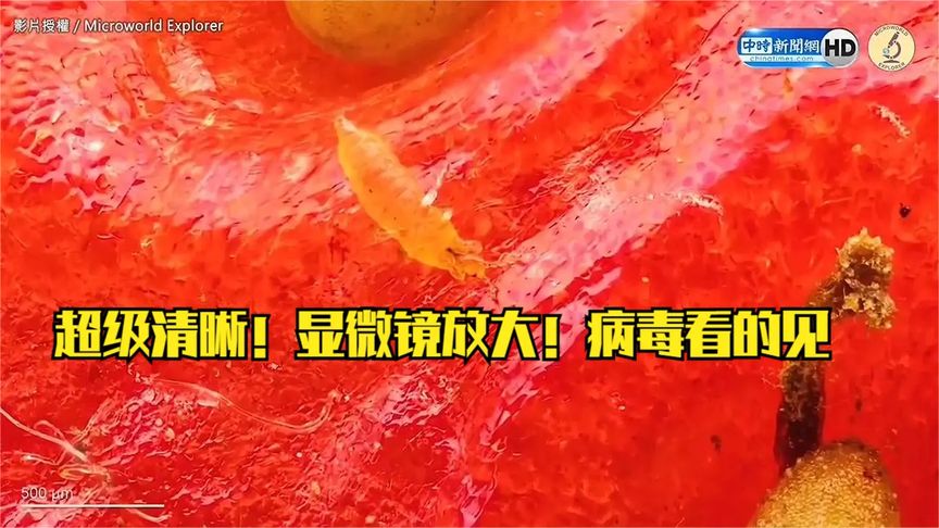 超级清晰!显微镜放大!病毒看的见!