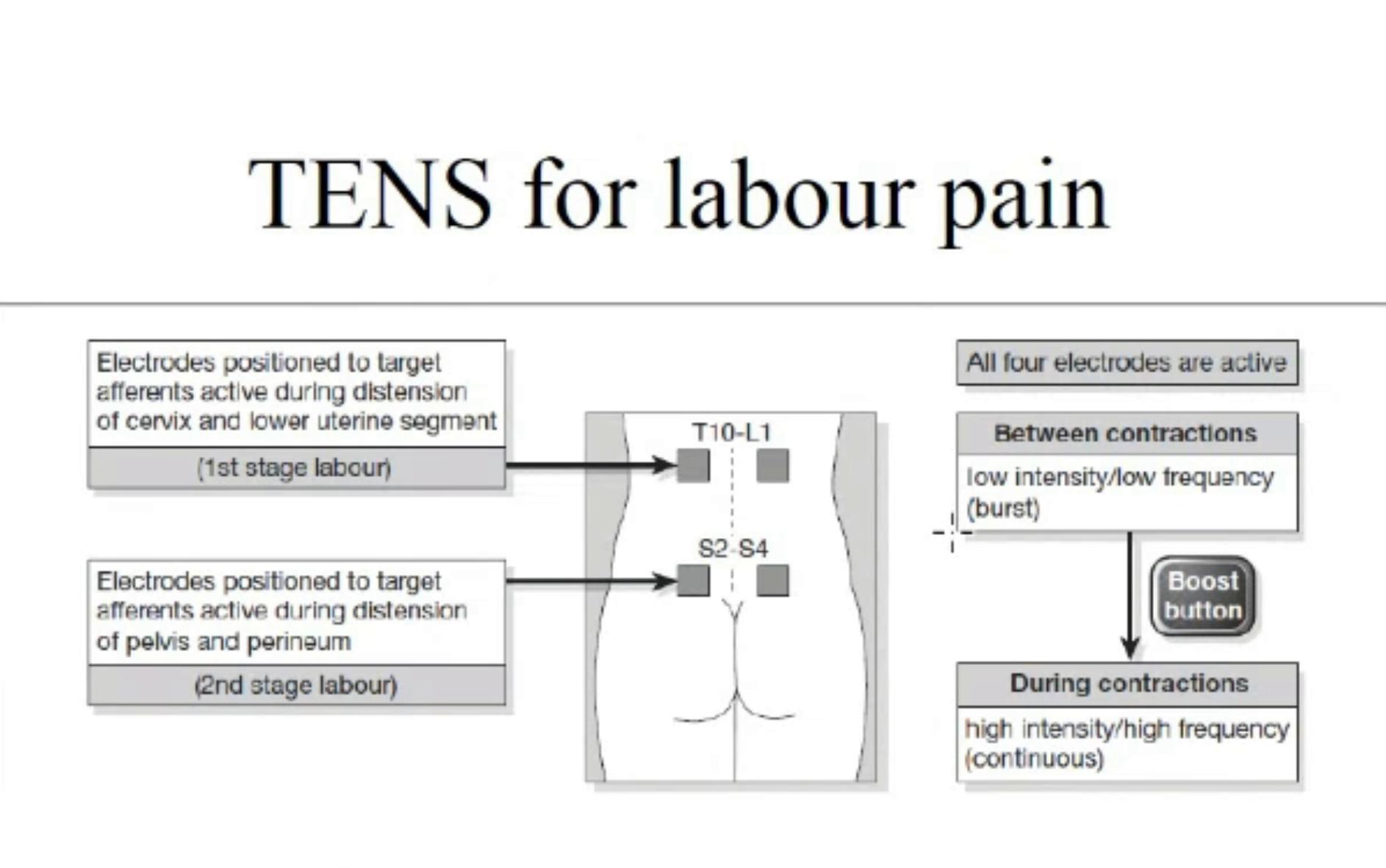 ...的适应症和禁忌症 TENS电极片的摆放原则 大学医学护理复健线上课程
