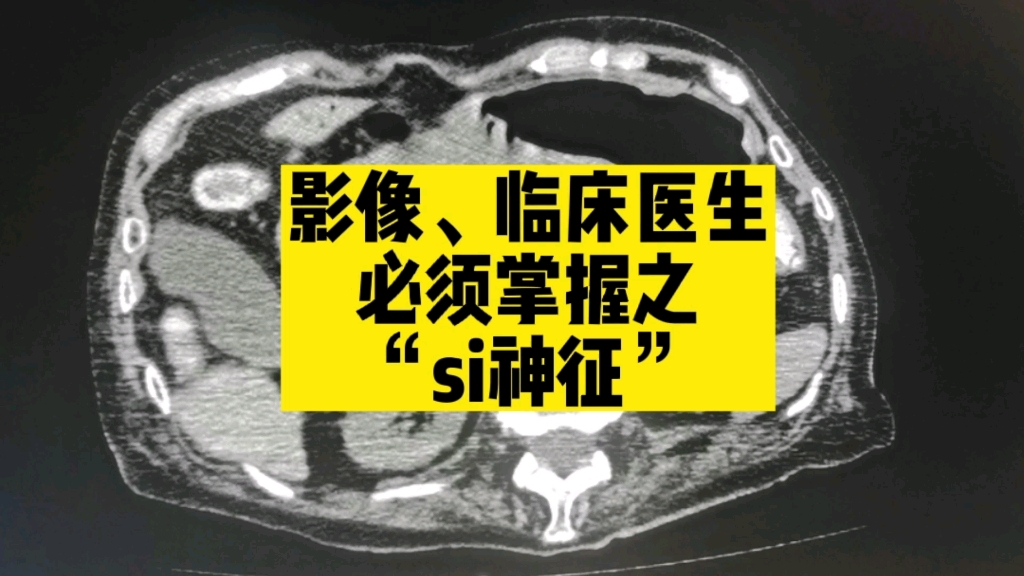 ...征”,门静脉积气,肠坏死,肠系膜上动脉栓塞。危急值 | 医学生 | 放射科