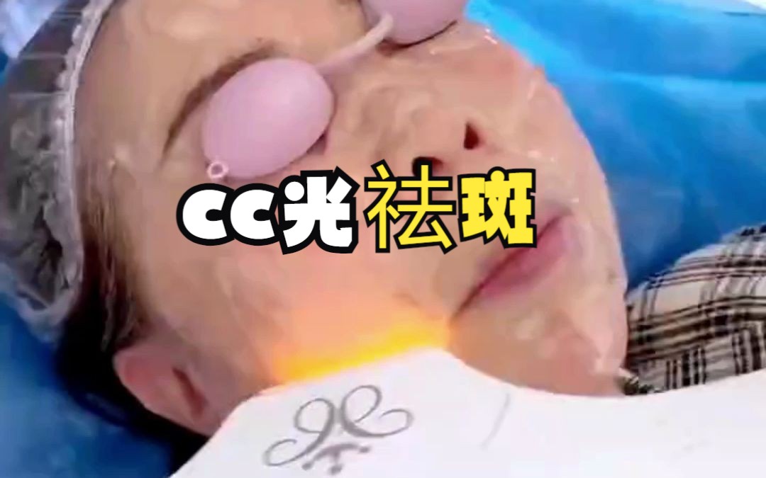 上海面部长斑可以去掉吗?