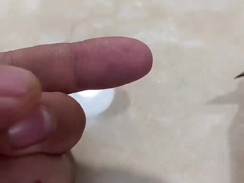一滴血液里有多少个细胞