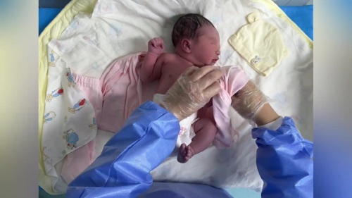 记录小宝贝刚出生的样子 刚出生的宝宝