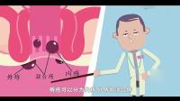 你知道痔疮是怎么形成的吗? 生活中我们该怎么预防呢?