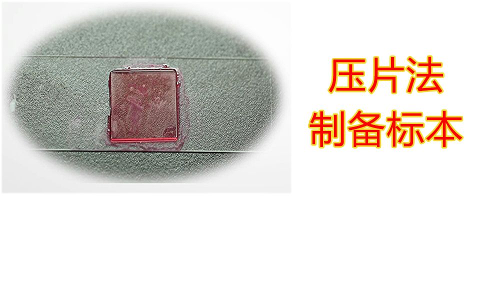 【实验】压片法制备洋葱根尖细胞染色体标本,醋酸洋红染色