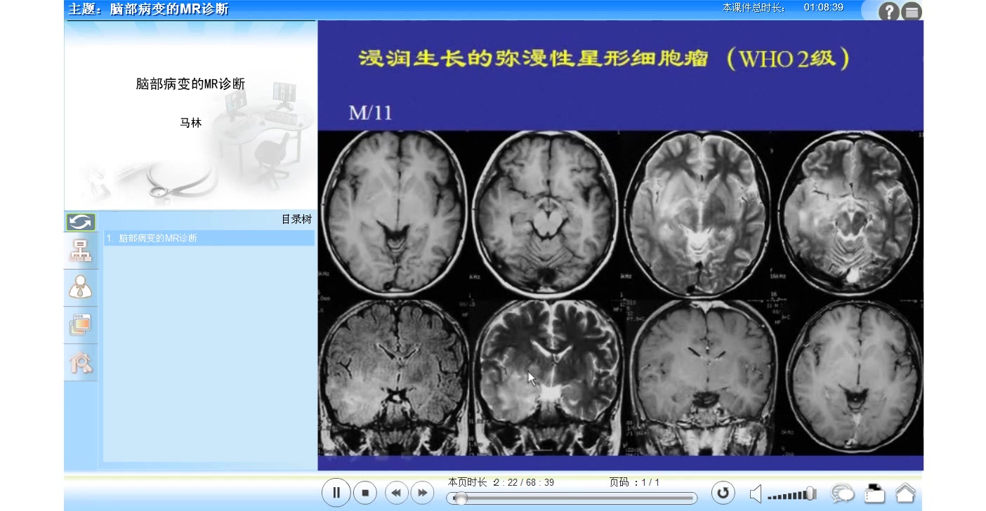 医学教材 核磁共振技术MRI初级培训 全24讲 附材料 视频教程
