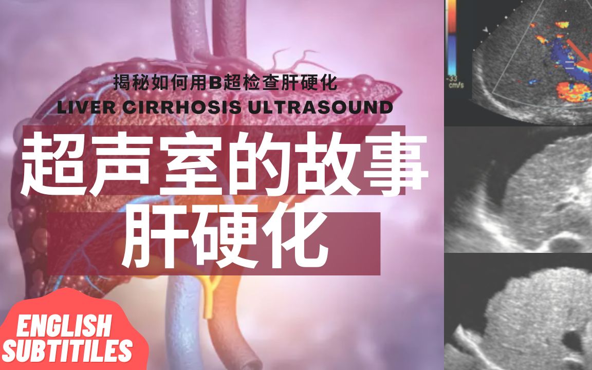 肝硬化:肝硬化是什么/肝硬化是如何形成的/ 常见症状和并发症/B超如何...