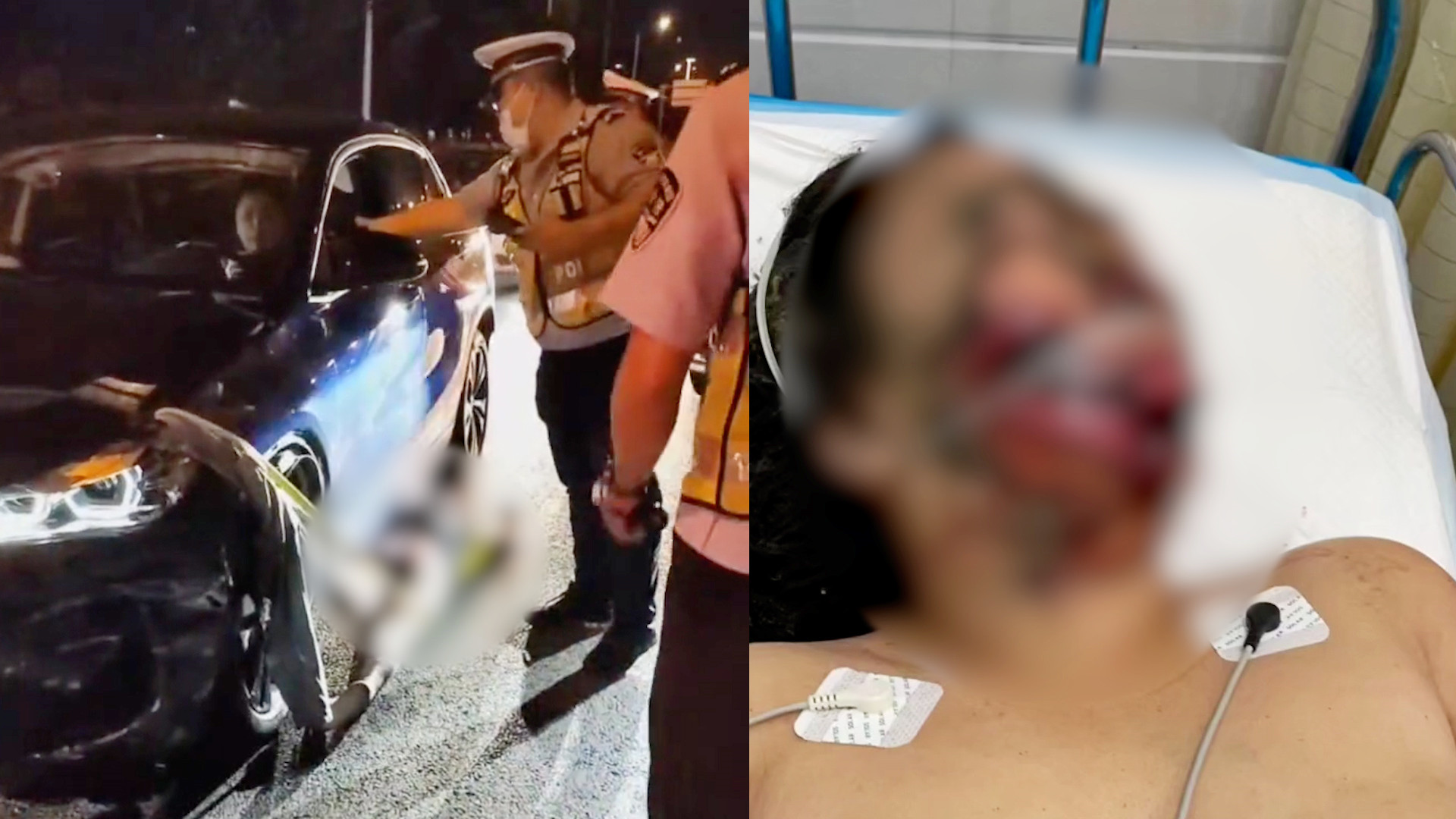 女子疑酒驾撞人拖行1公里,受害人全身惨不忍睹,交警拦下后怒斥