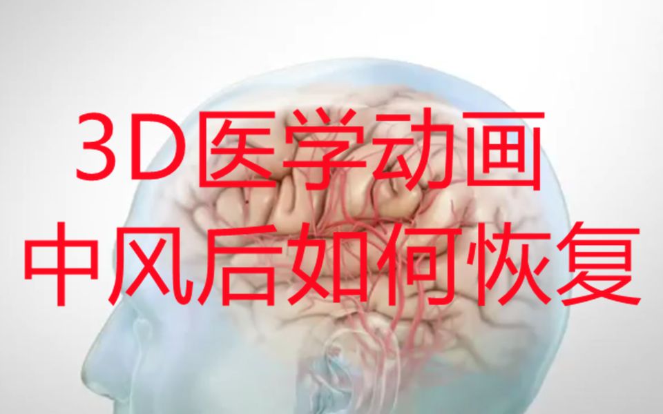 中风后恢复科普-3D医学动画