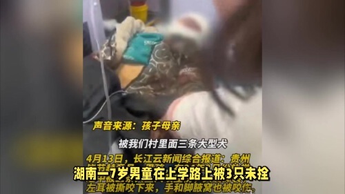 男孩被狗咬毁容:狗主人仅赔5万!谁该为孩子买单?