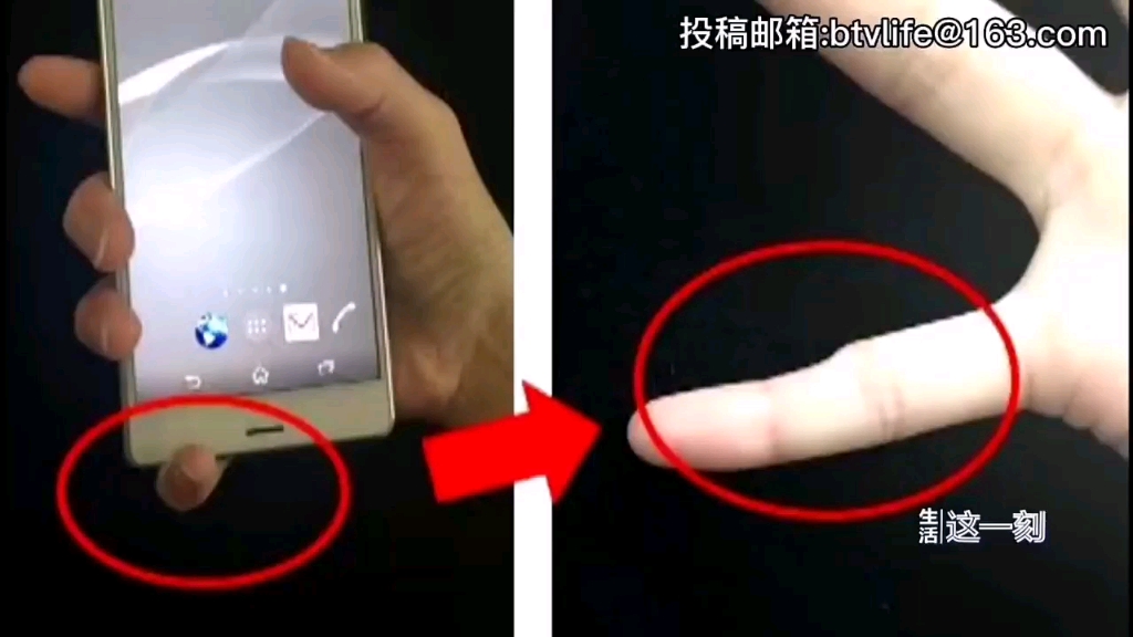 玩手机会导致小拇指变形?听听医生怎么说