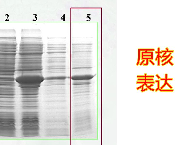 【实验】原核表达系统设计全流程,大肠杆菌BL21(DE3),Rosetta,酵母,...