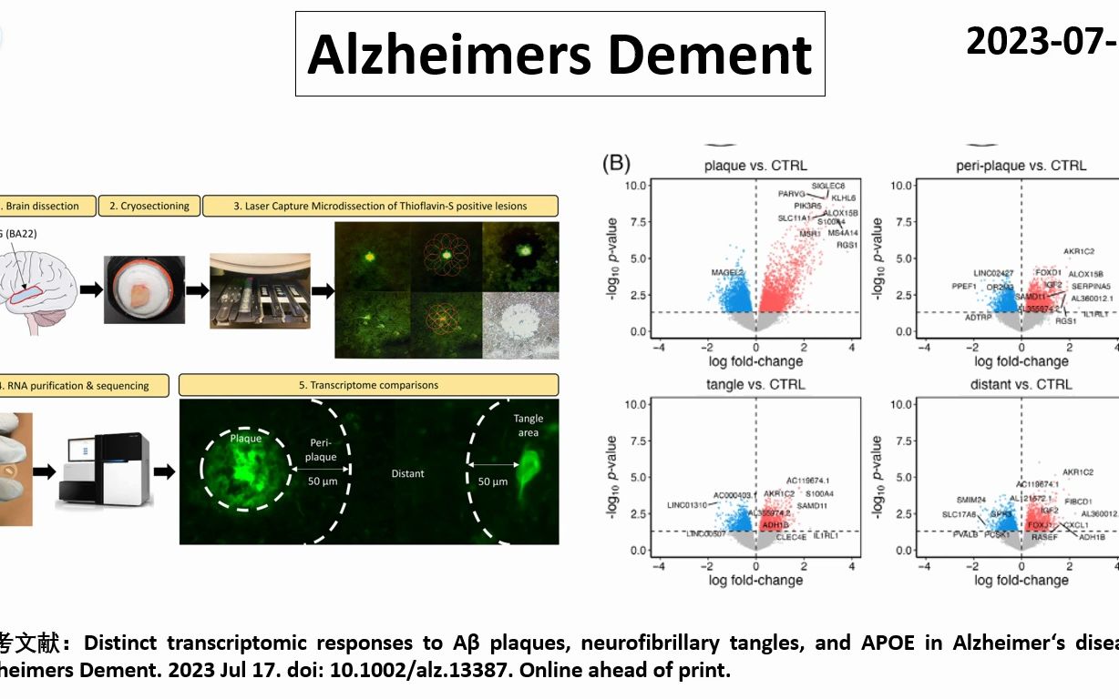 Alzheimers Dement—Aβ对大脑基因表达的影响要强于NFT,且受到...