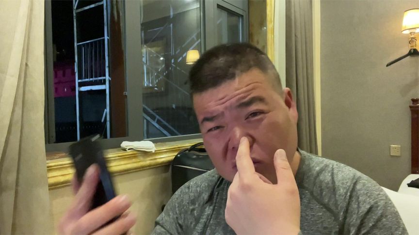 你眼底出血,毛细血管爆炸,你看你眼睛红的