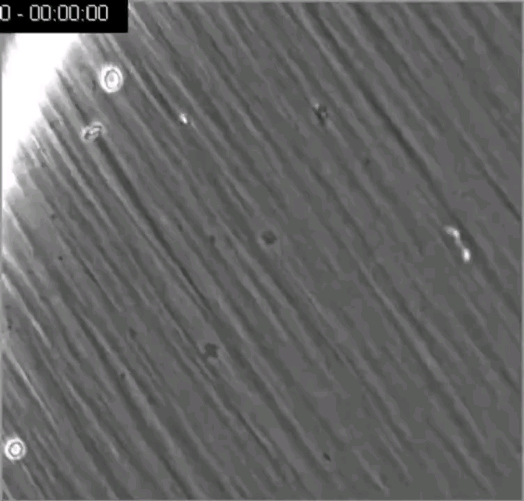 显微镜下造血干细胞分化形成巨噬细胞