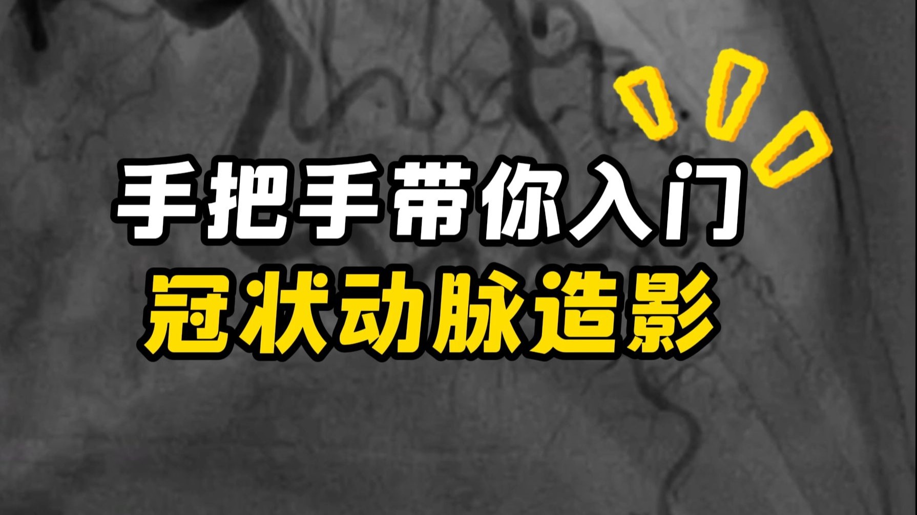手把手带你入门冠状动脉造影