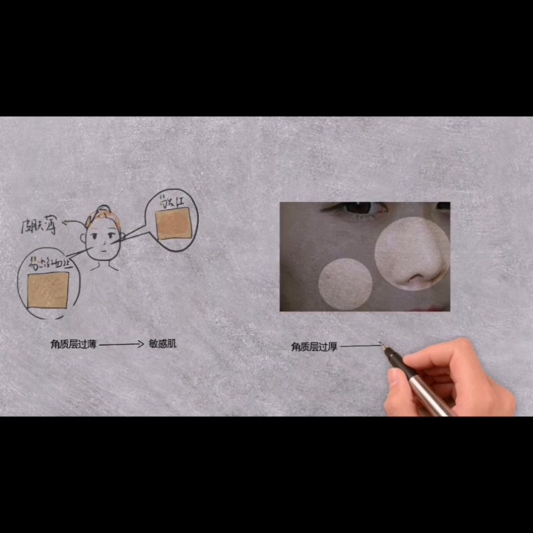 零基础认识皮肤结构,看完整个人皮肤都变好了