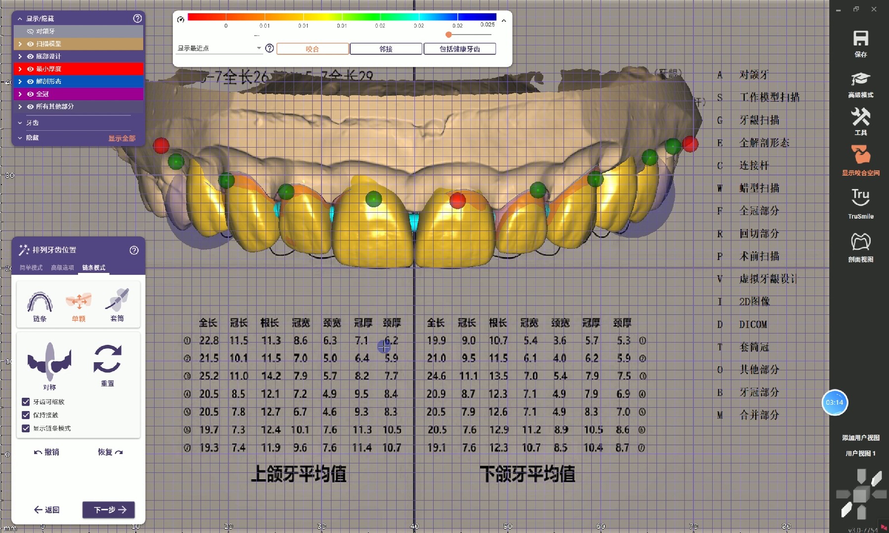 exocad数字化设计 前牙全形态设计