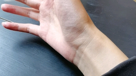 你们有这种吗?肉眼可见的血管跳动