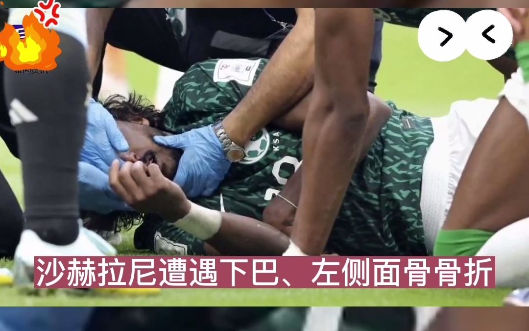 沙特王储用私人飞机送球员治伤