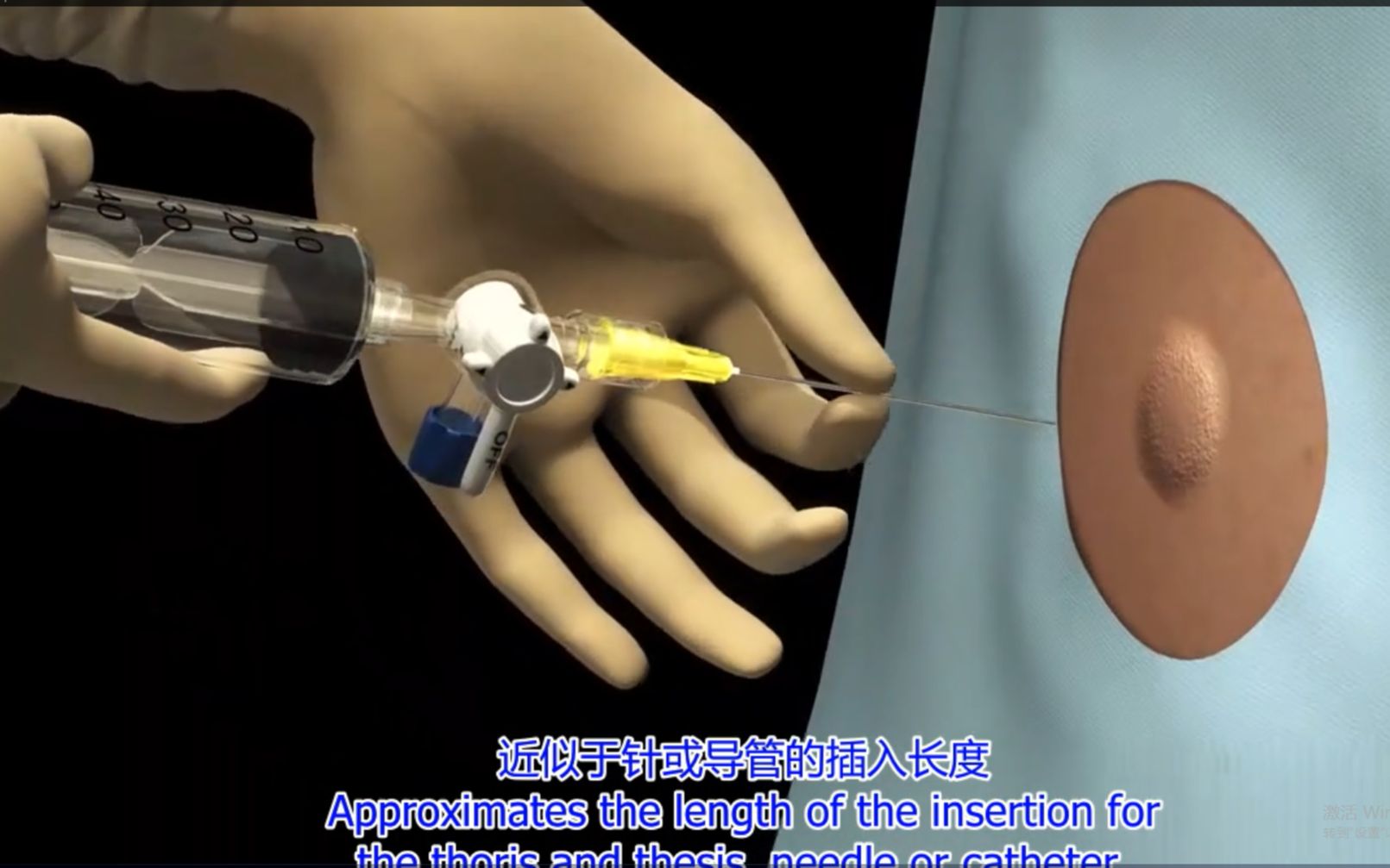 3D医学视频演示胸腔穿刺术
