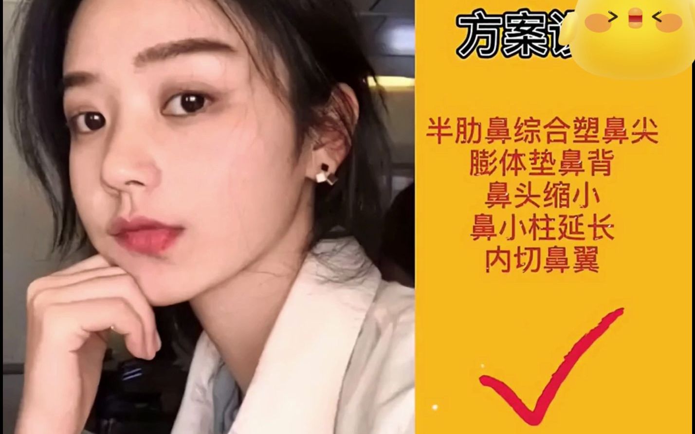那么缩小鼻翼的方式有哪些?