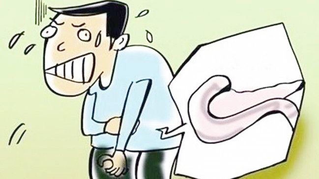 做痔疮手术痛不痛?听完这些你就大可放心啦!