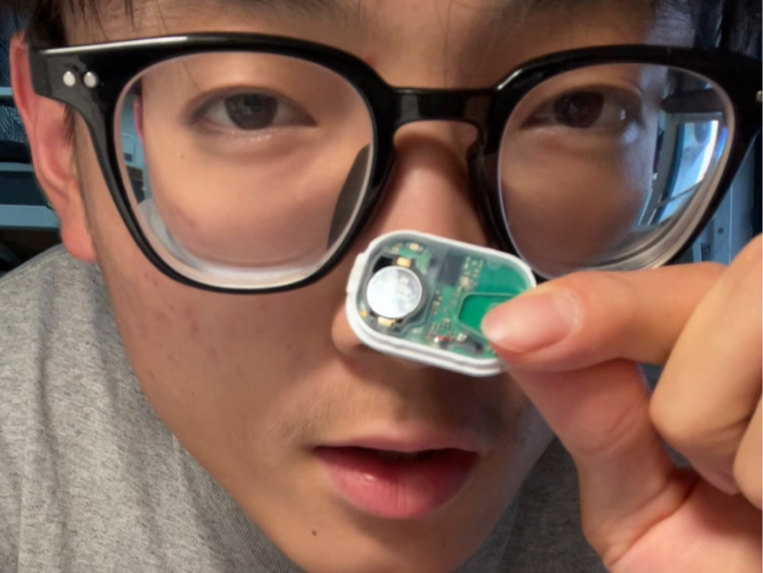 硅基百元新品?一型糖尿病人硅基轻享版首发体验!