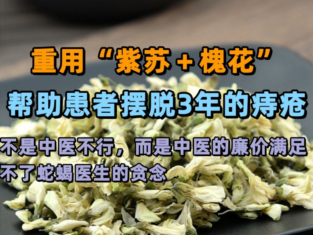 重用“紫苏+槐花”,帮助患者摆脱3年的痔疮
