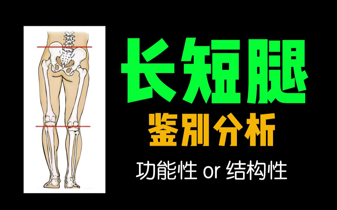 功能性长短腿和结构性长短腿的鉴别与分析