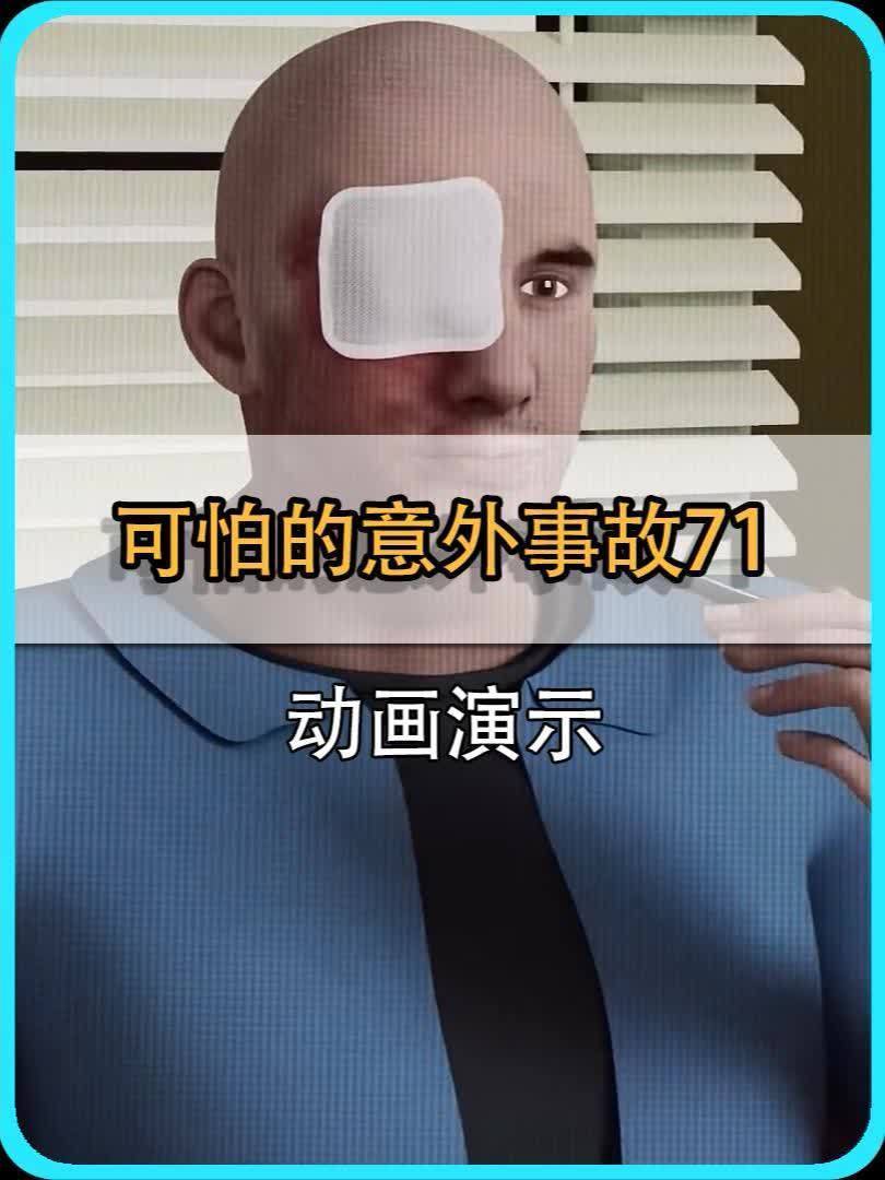 男人修理电线被电伤 名场面 动画演示