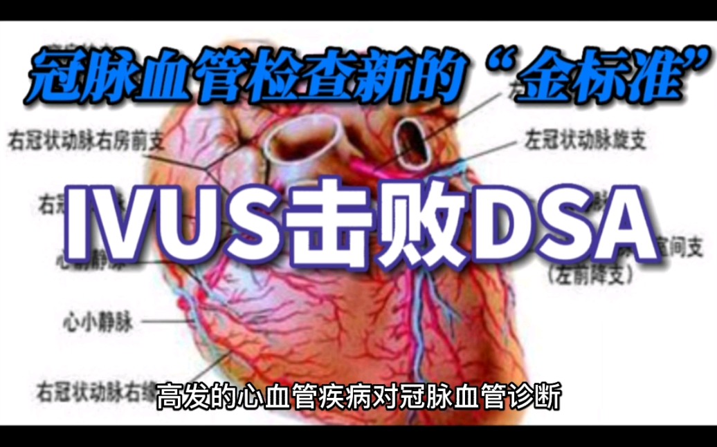 INUS成功击败DSA晋升为冠脉检查新的''金标准"