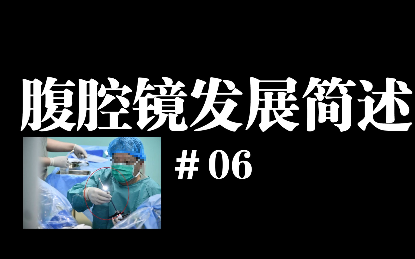 腹腔镜发展简述#06