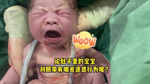 产房实拍:医生把孕妇的腹部打开时,眼前的一幕太意外