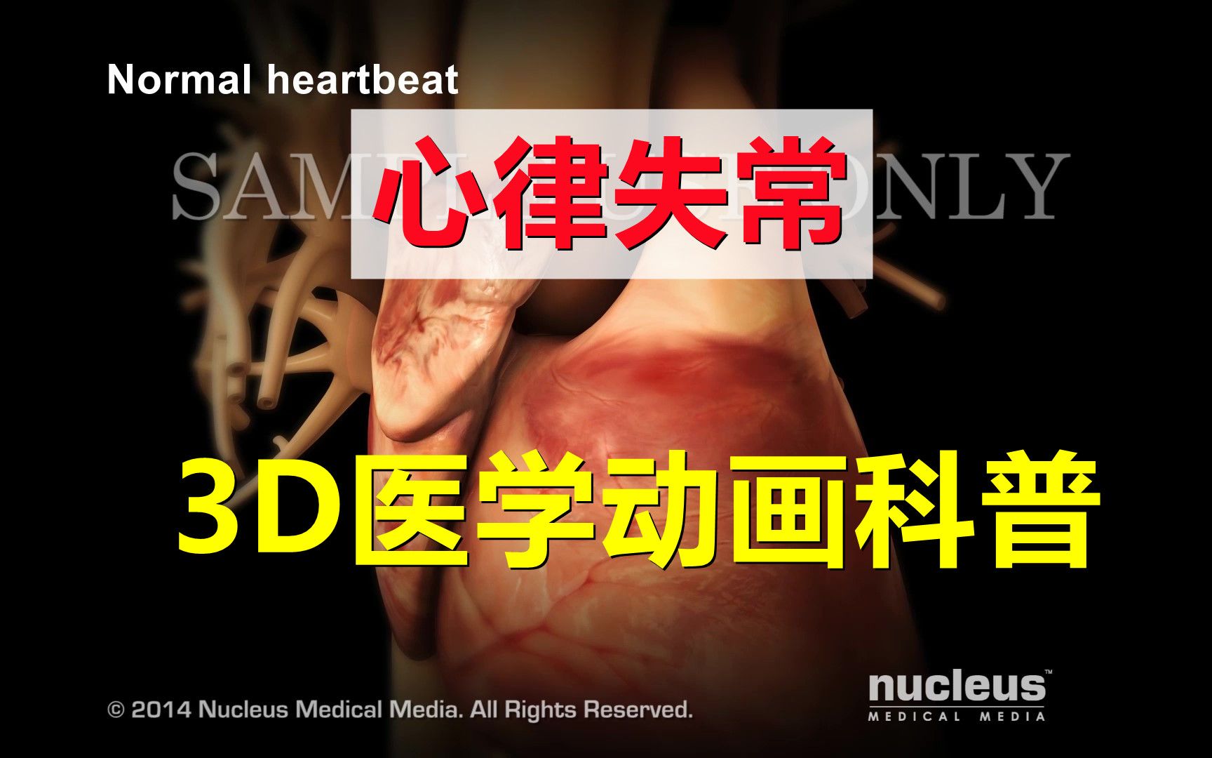 【3D医学动画科普】心率失常(中英双语字幕)