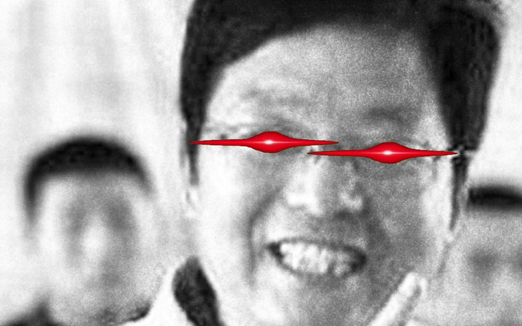 电疗!MECT电休克治疗全记录