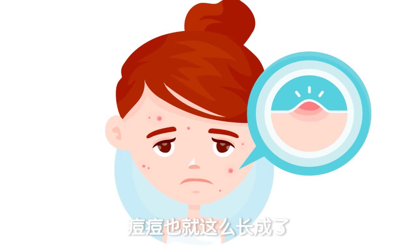 为什么过了青春期还是有“青春痘”?动画还原痘痘生长全过程,痤疮.