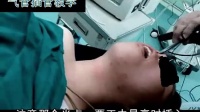困难气道插管
