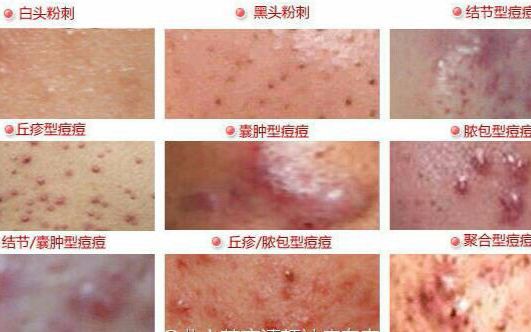 过度清洁对肌肤真的好吗?不妨来看看护肤老师怎么说