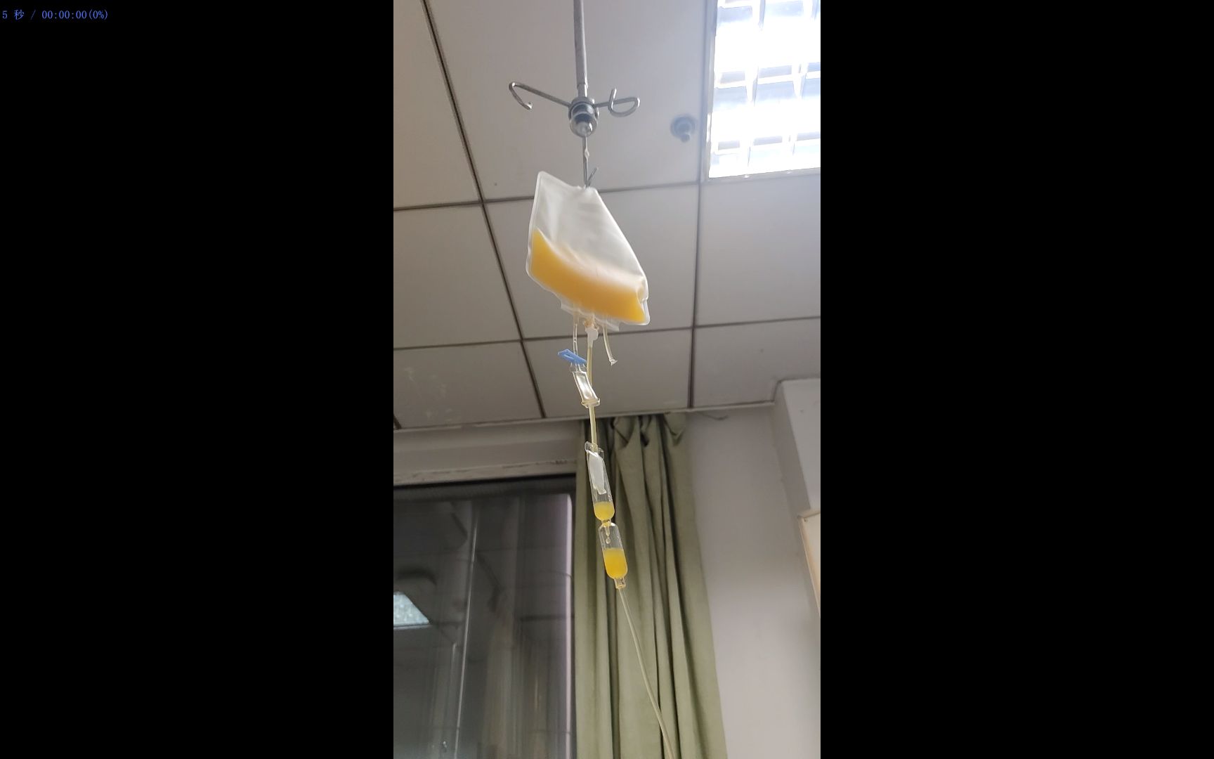 我得了新冠并发症 希望大家能重视