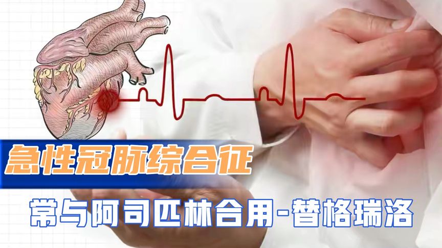 常与阿司匹林合用-替格瑞洛,正确打开方式您了解吗?