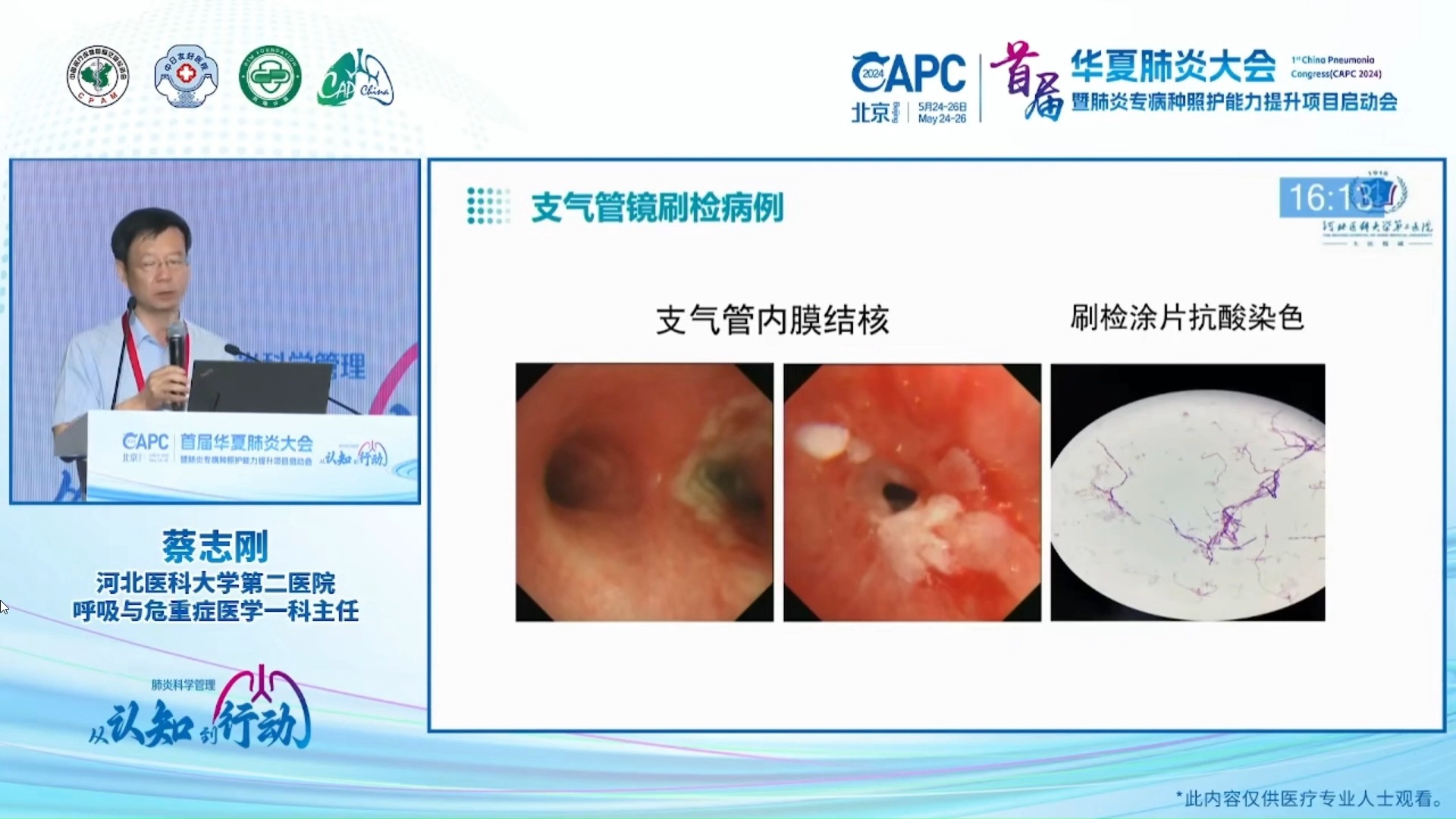 气管镜在肺部感染性疾病中的应用 蔡志刚