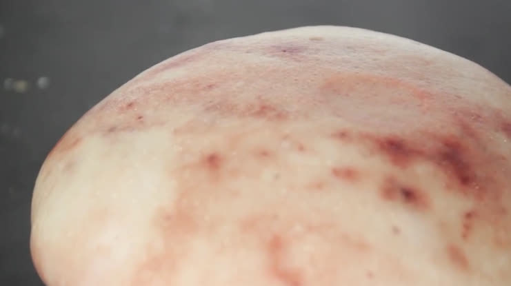 过氧化氢和血液混合在一起,这样的现象还是第一次见,.