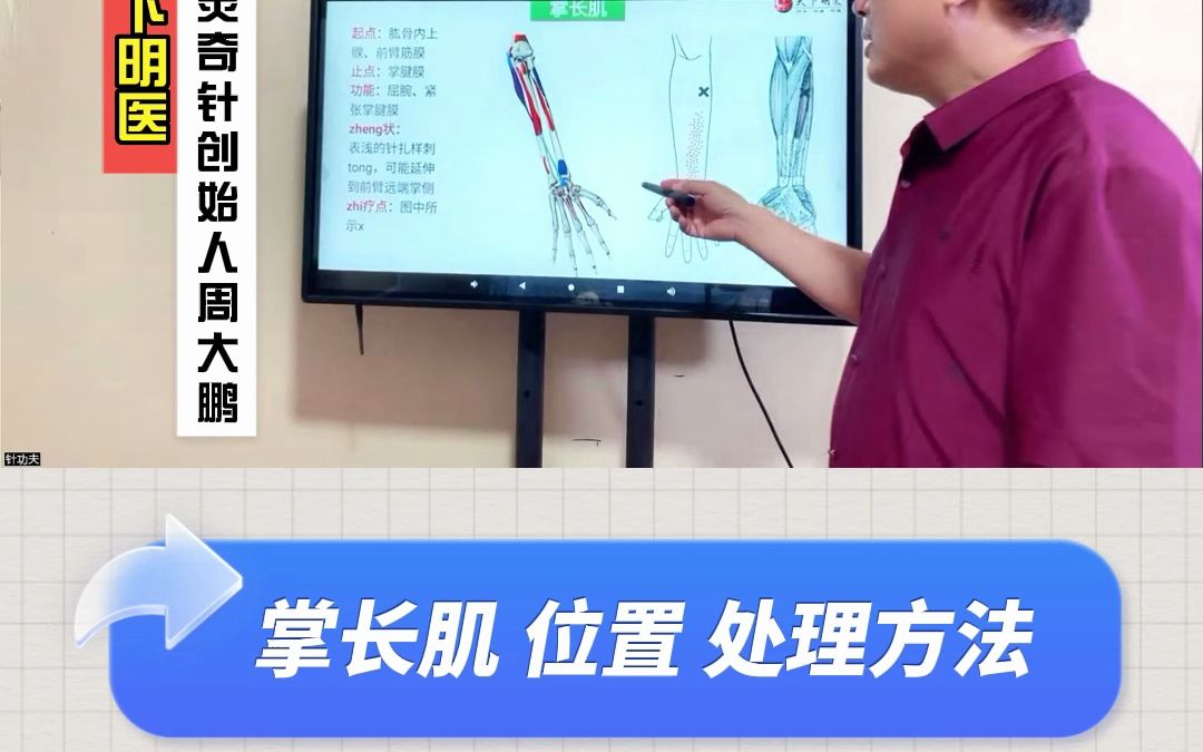 掌长肌 位置 处理方法——天下明医平台简灵奇针 创始人周大鹏老师...