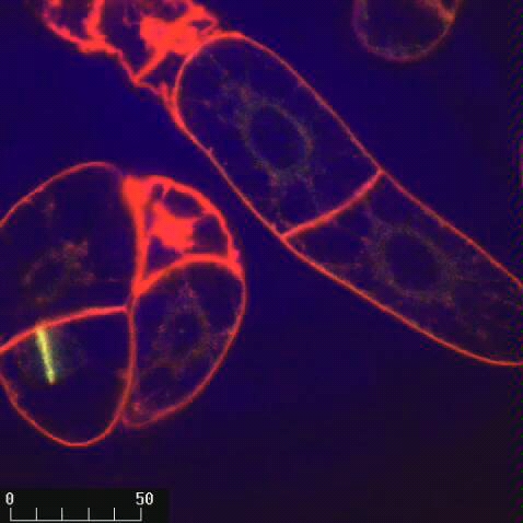 【植物百科】细胞板,显微镜下的植物细胞,细胞生物学教学视频,生物...