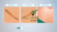 皮肤吻合器动画皮肤缝合器动画百合医疗动画