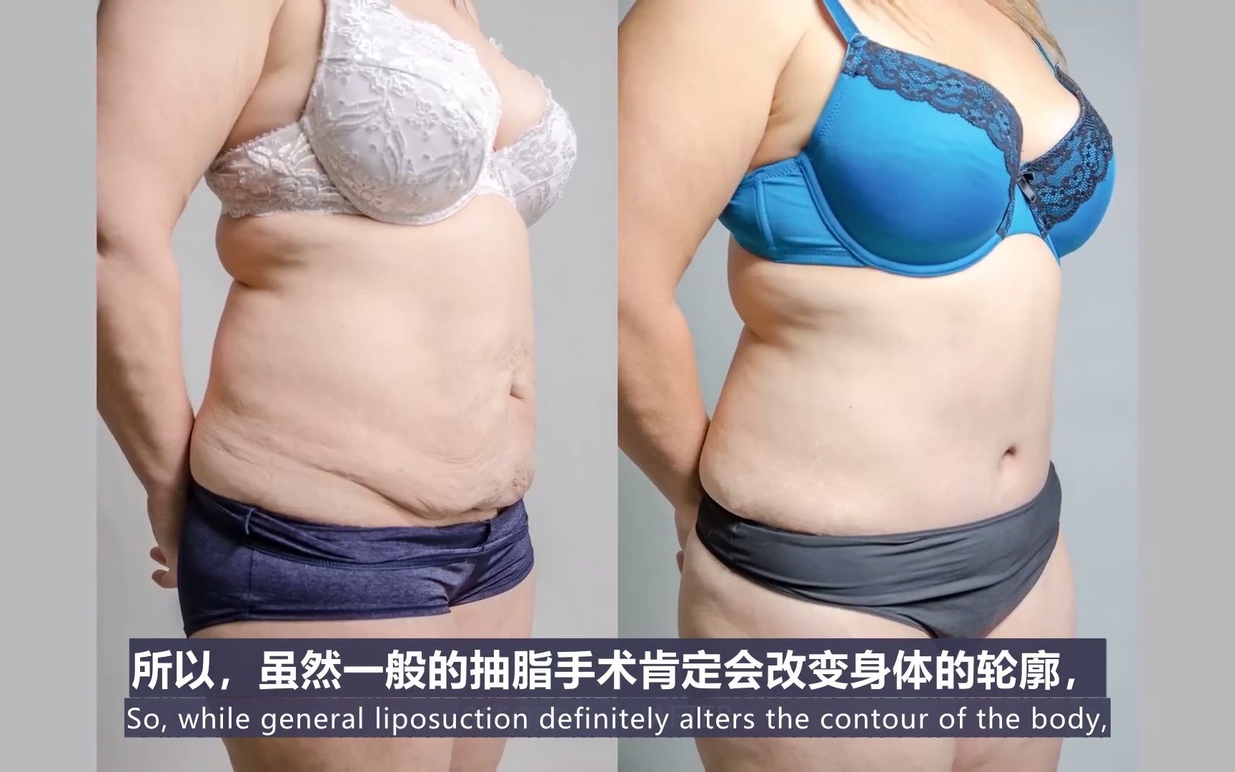 从抽脂术到解剖学 | 大体老师来了